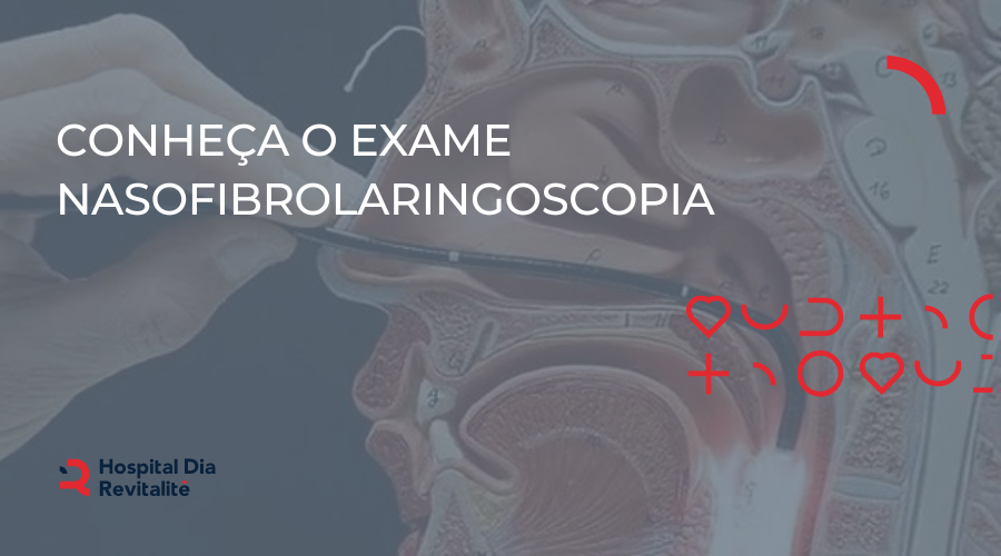 Conheça o exame nasofibrolaringoscopia - Hospital Dia Revitalite