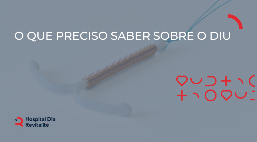 O que preciso saber sobre o DIU - Hospital Dia Revitalite